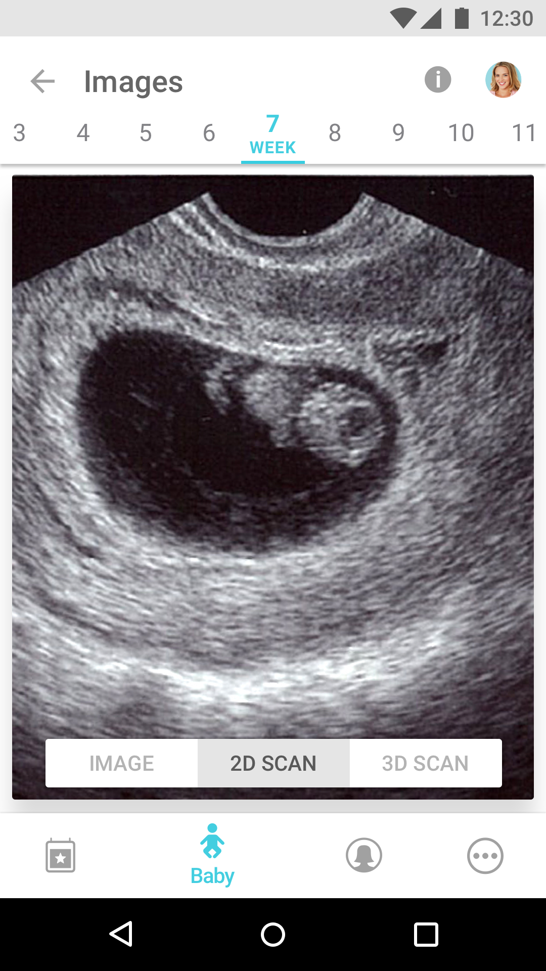 Pregnancy+ (EN) - Philips
