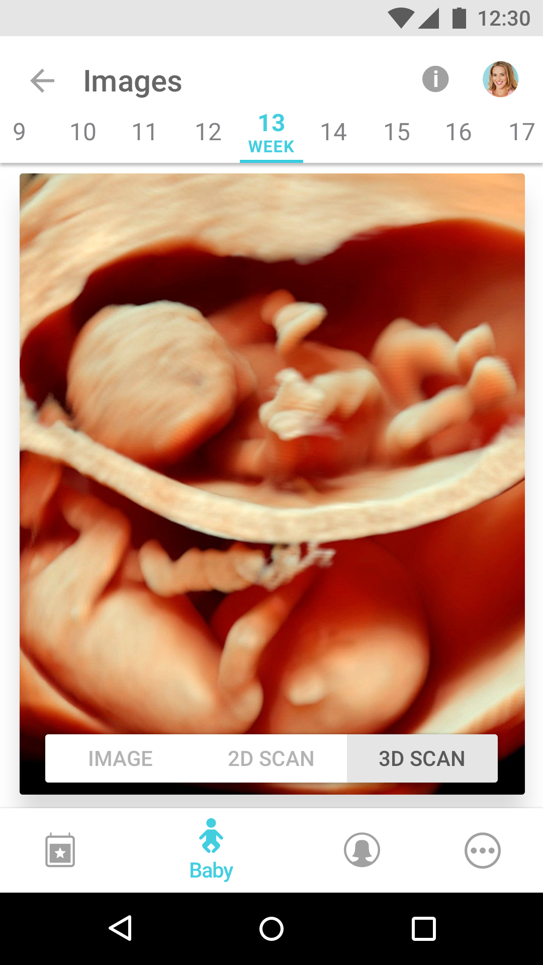 Pregnancy+ (EN) - Philips